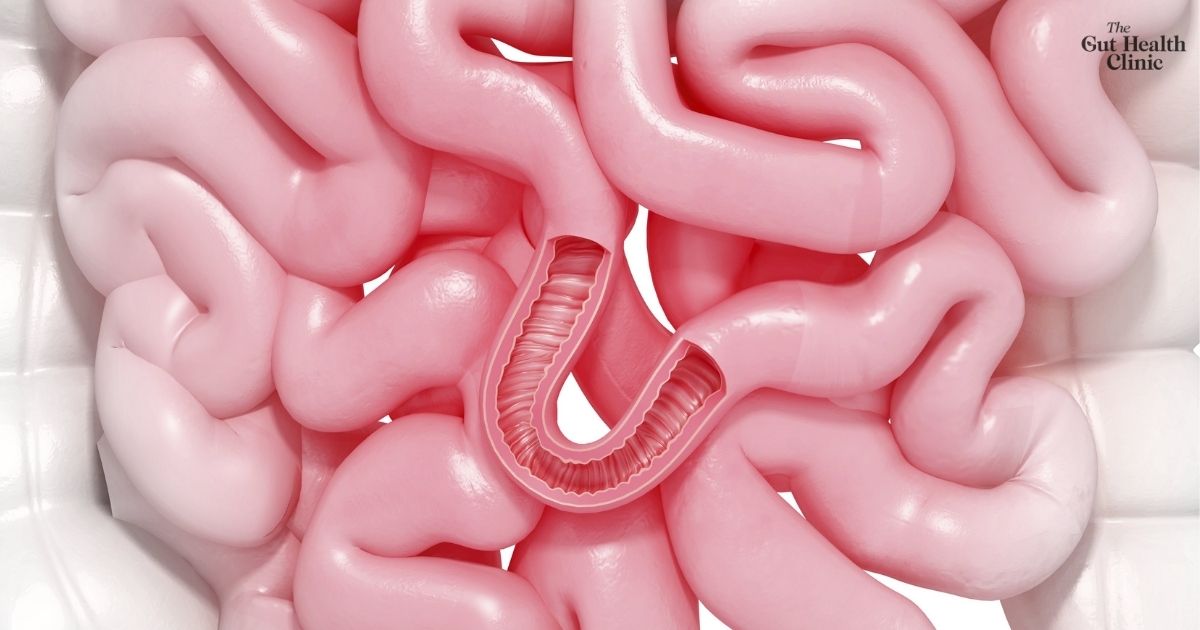 Get to Know Small Intestinal Bacterial Overgrowth (SIBO) | The Gut ...
