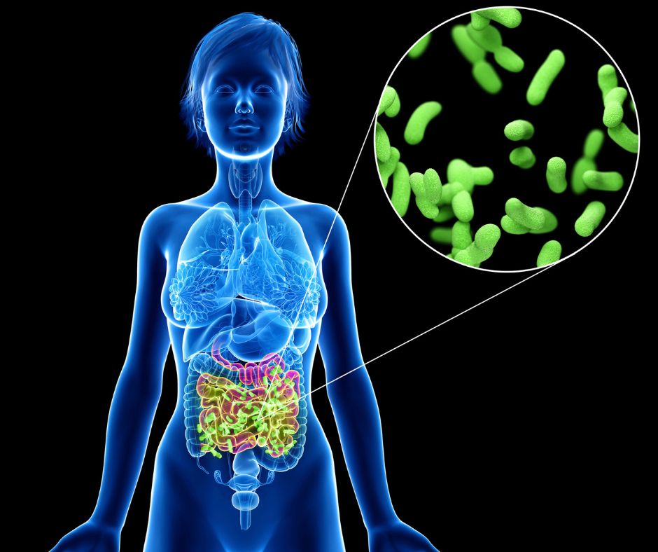 Intestinal Methanogenic Overgrowth (IMO) | The Gut Health Doctor